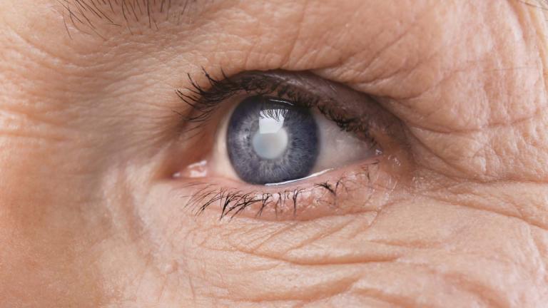 Blurry vision – how to manage eye problems that affect your daily life