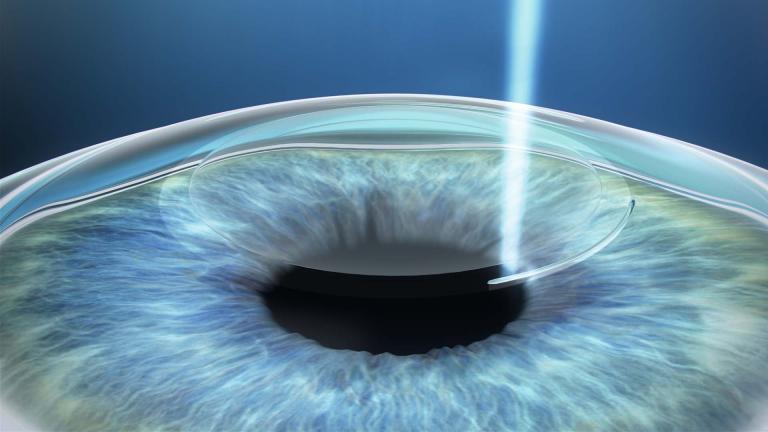 Blurry vision – how to manage eye problems that affect your daily life